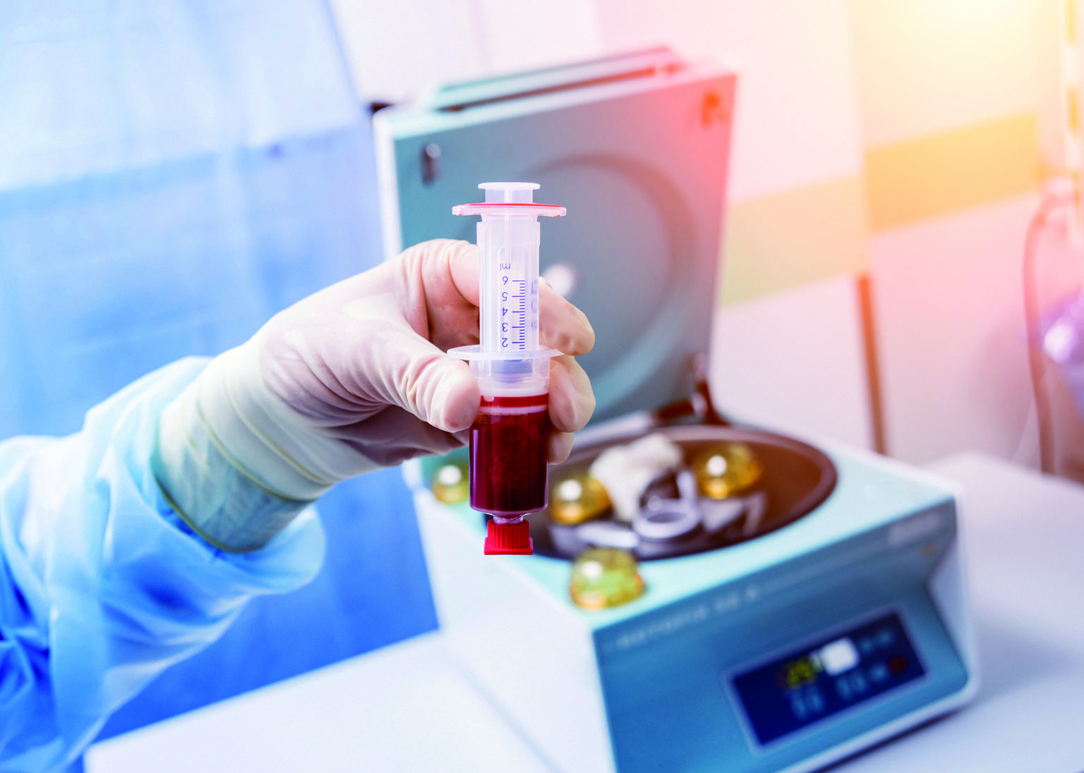 Plasma Riche en Plaquettes: une colle biologique pour vos blessures ...